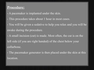 Cardiac Pacemakers and its Modes.pptx