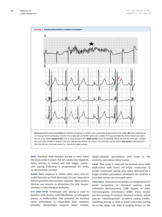 Cardiac pacemakers part-I | PDF