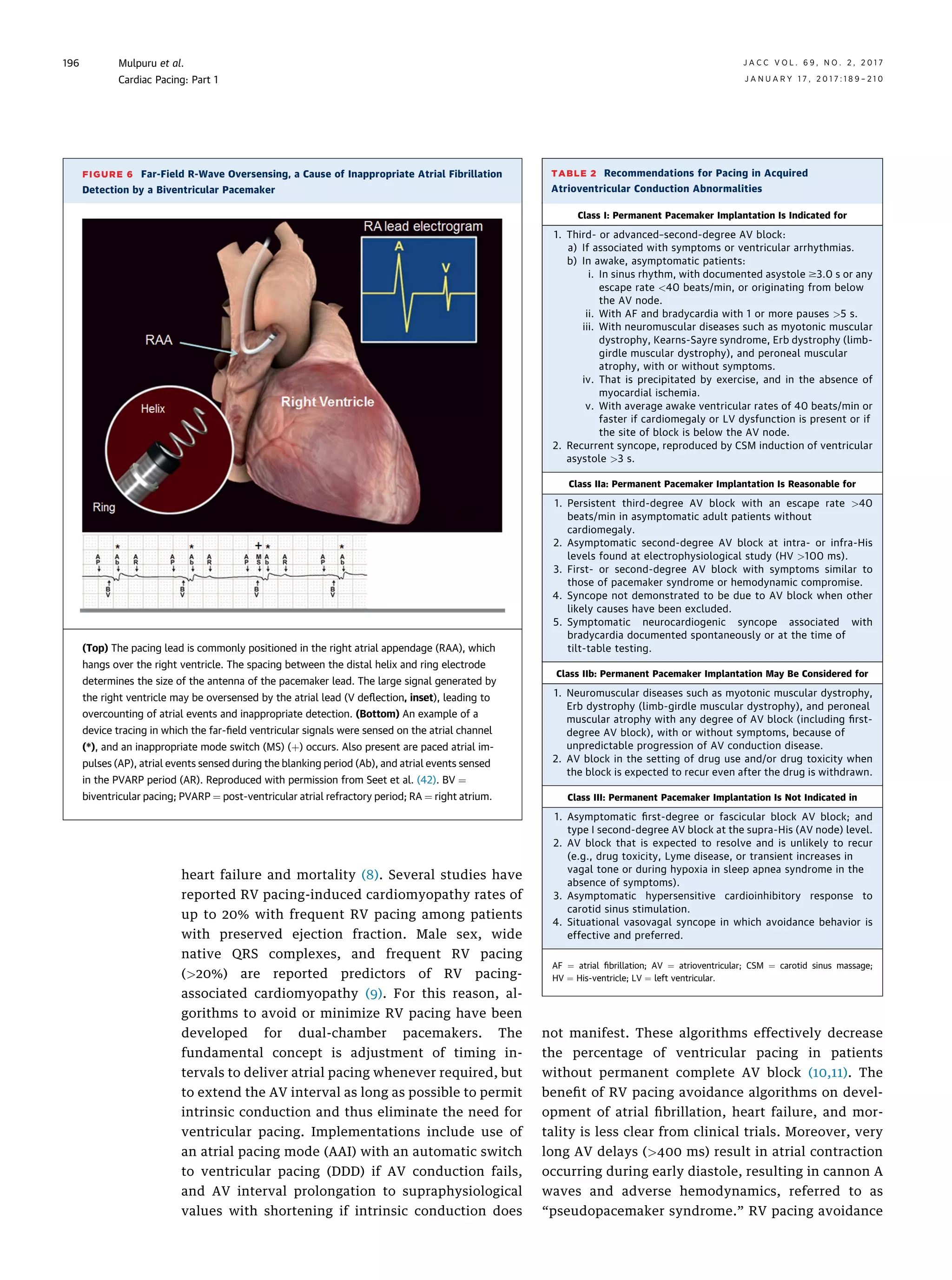 Cardiac pacemakers part-II | PDF