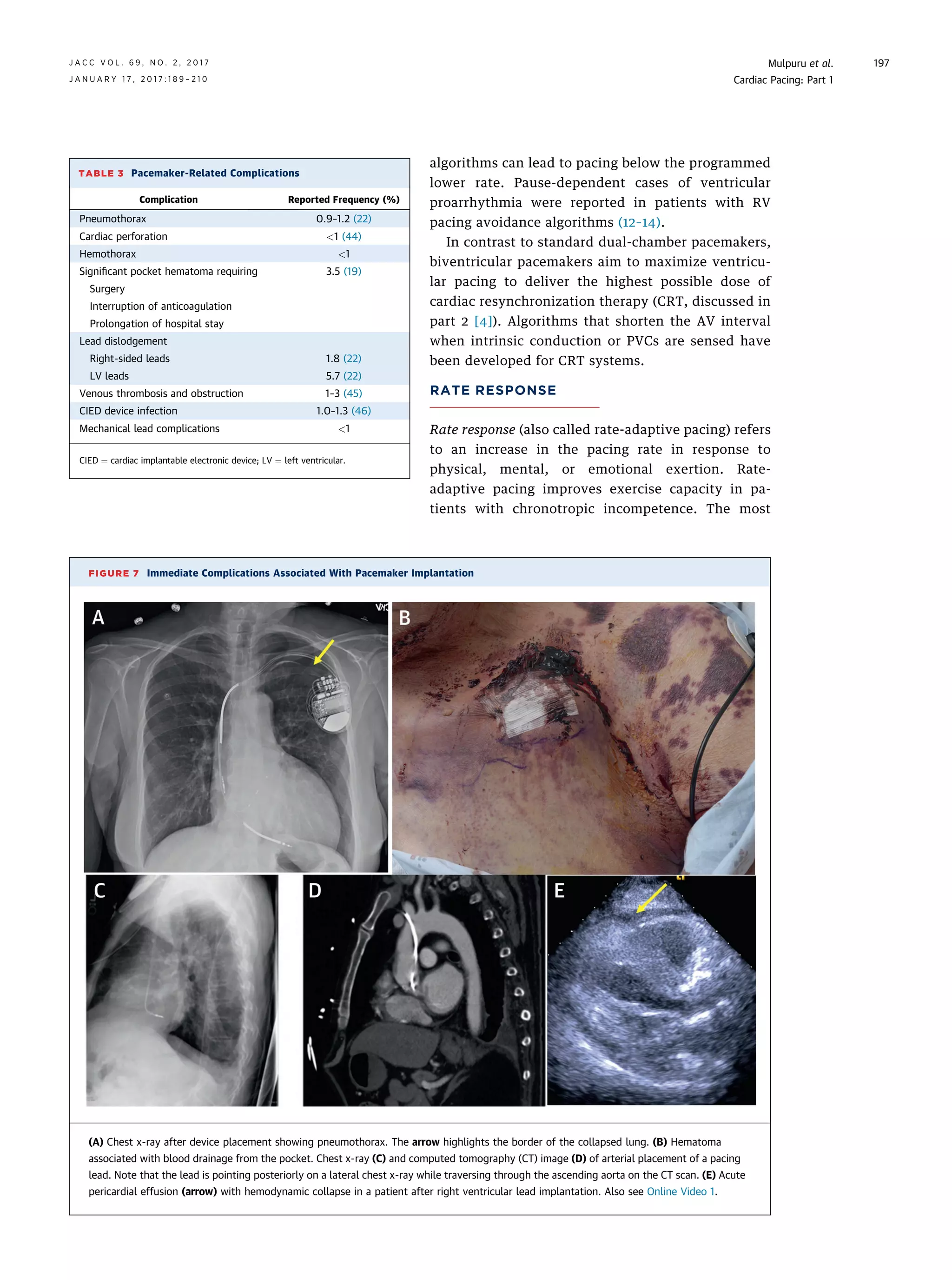 Cardiac pacemakers part-II | PDF
