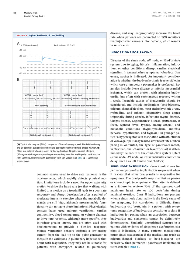 Cardiac pacemakers part-II | PDF