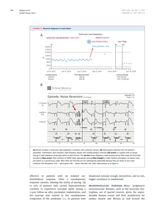 Cardiac pacemakers part-II | PDF