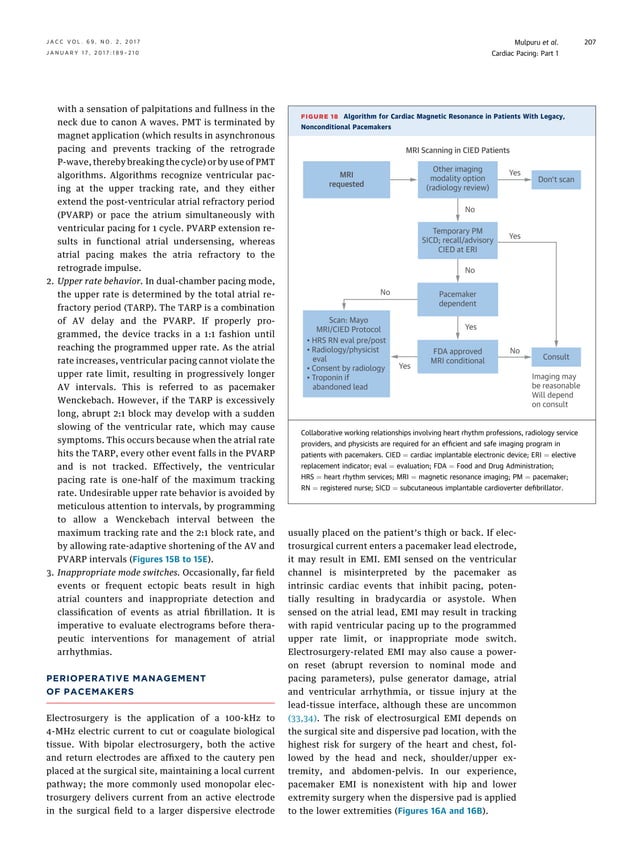 Cardiac pacemakers part-II | PDF