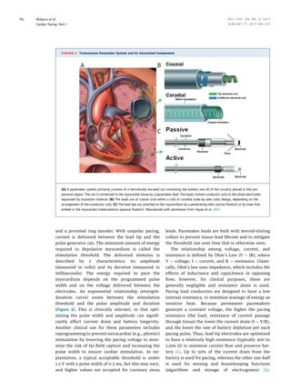 Cardiac pacemakers part-II | PDF