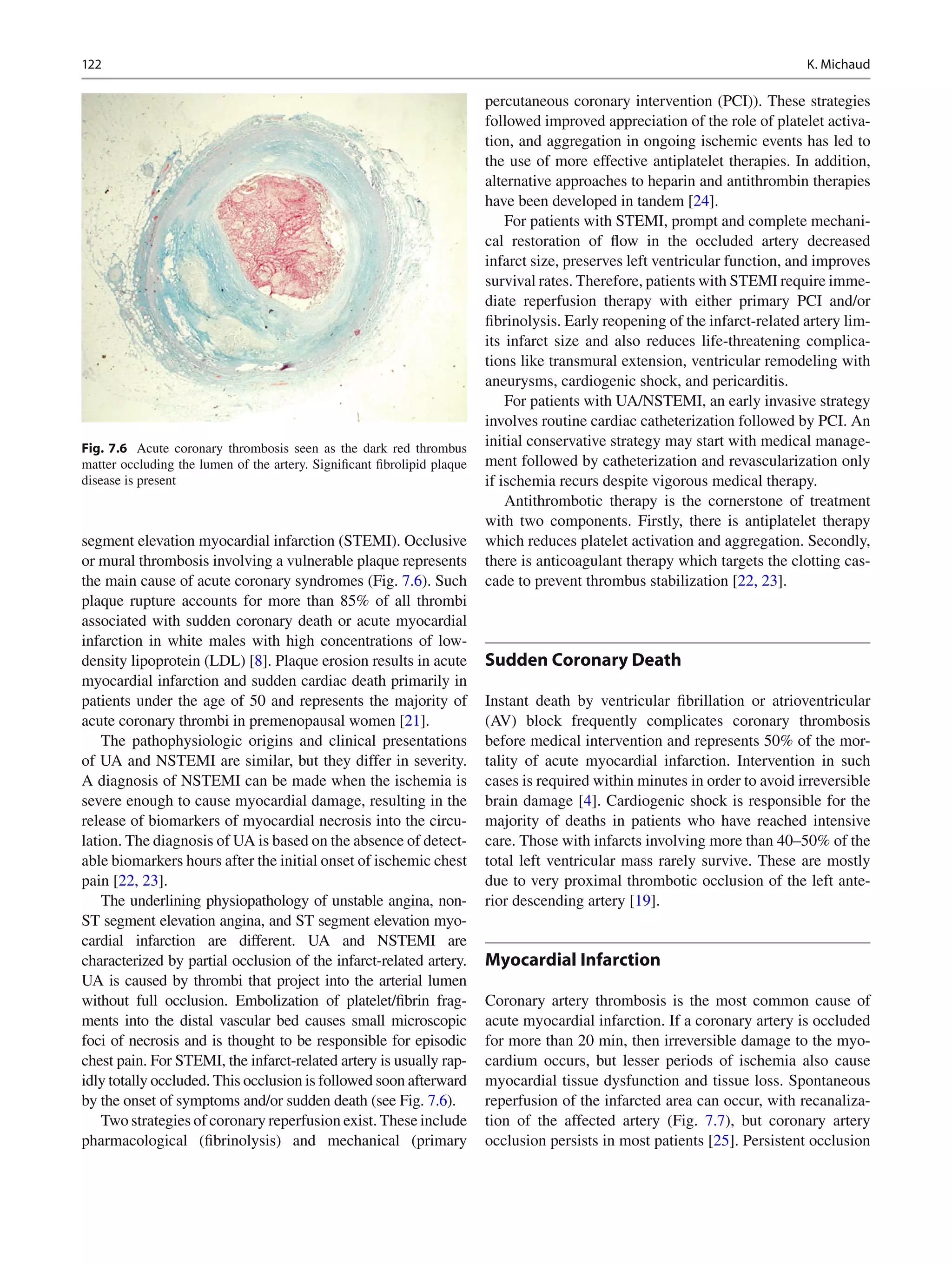 Cardiac pathology | PDF