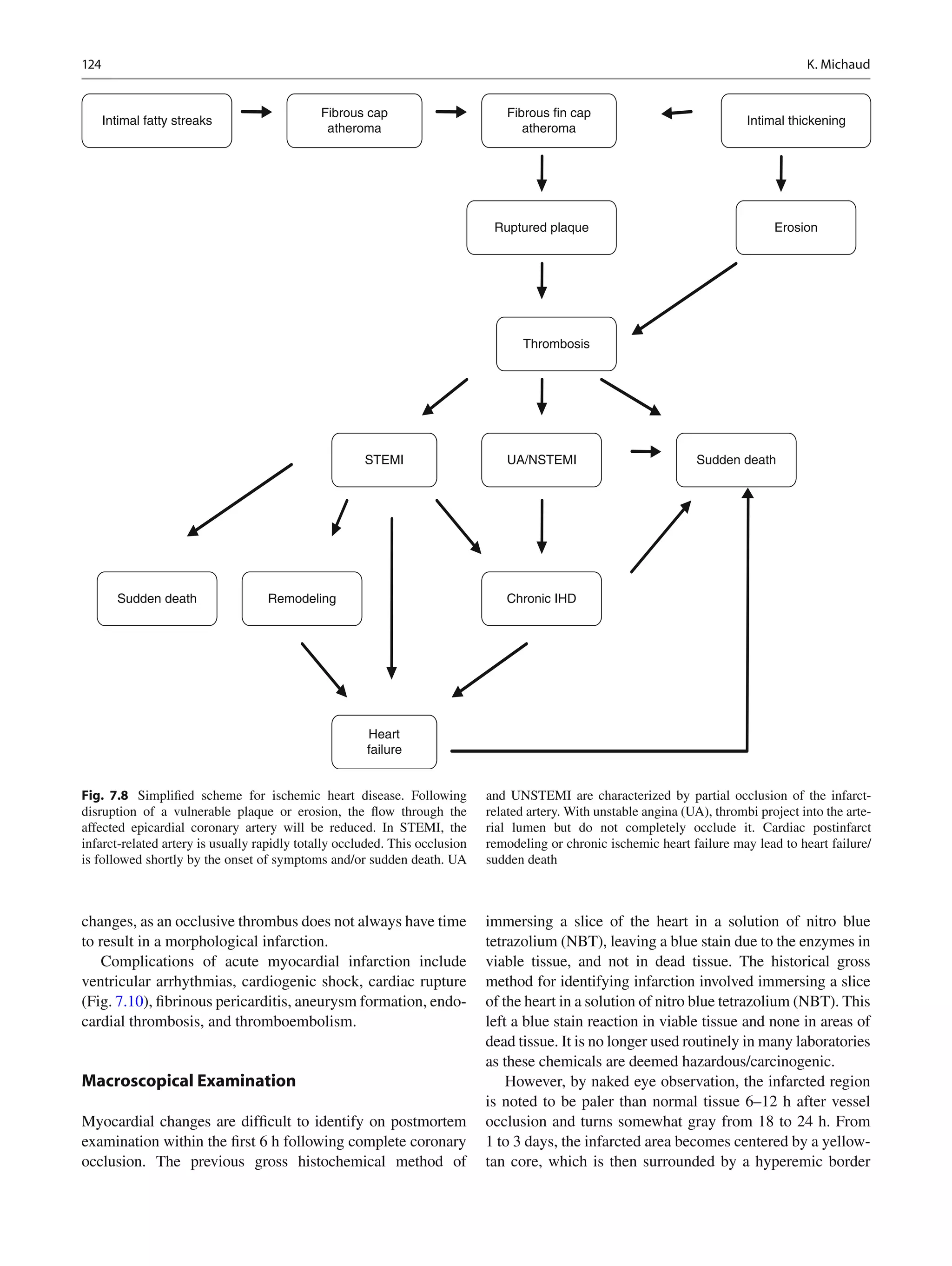 Cardiac pathology | PDF