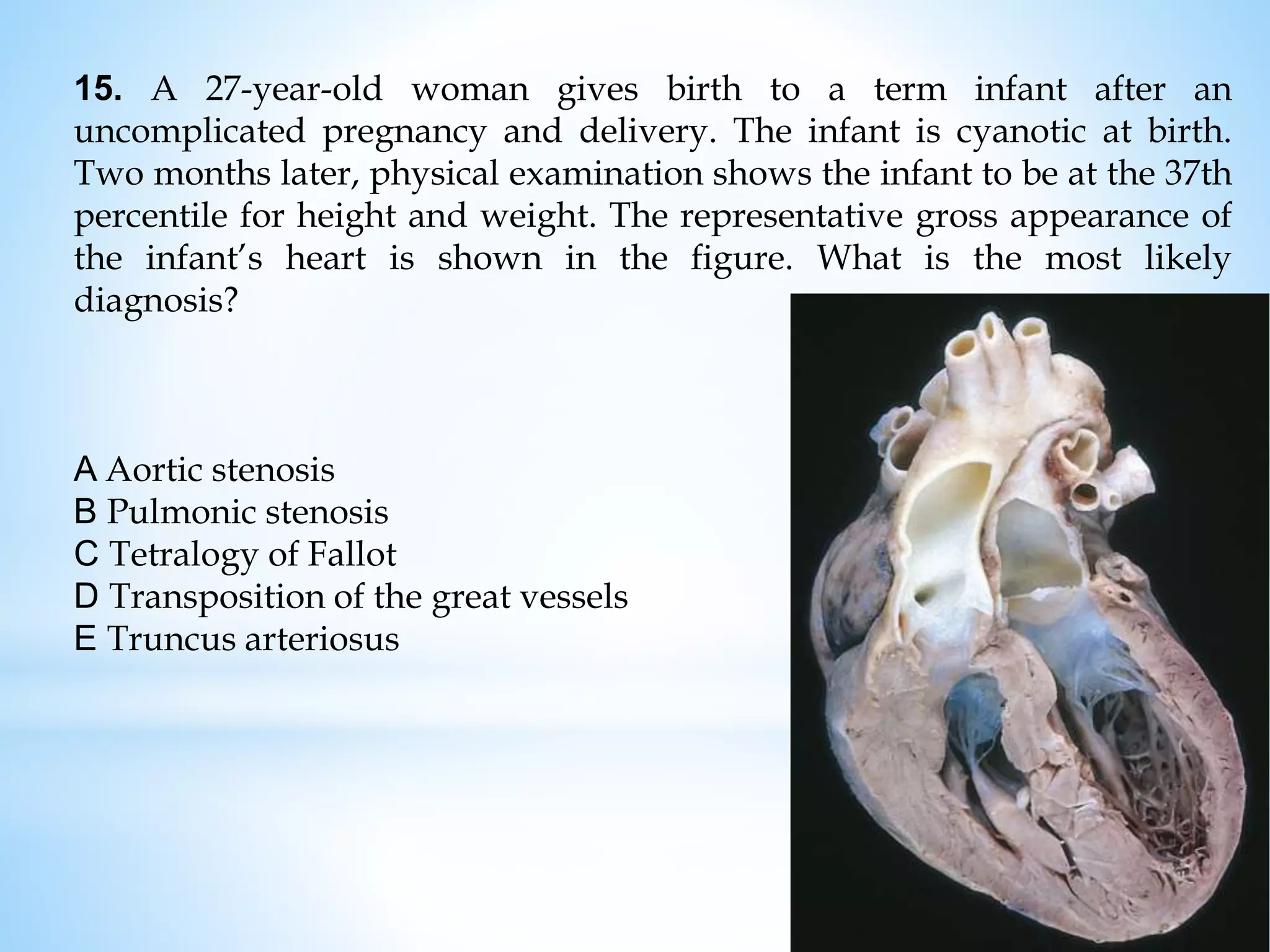 CARDIAC PATHOLOGY (MCQ QUESTIONS & ANSWERS) | PPTX
