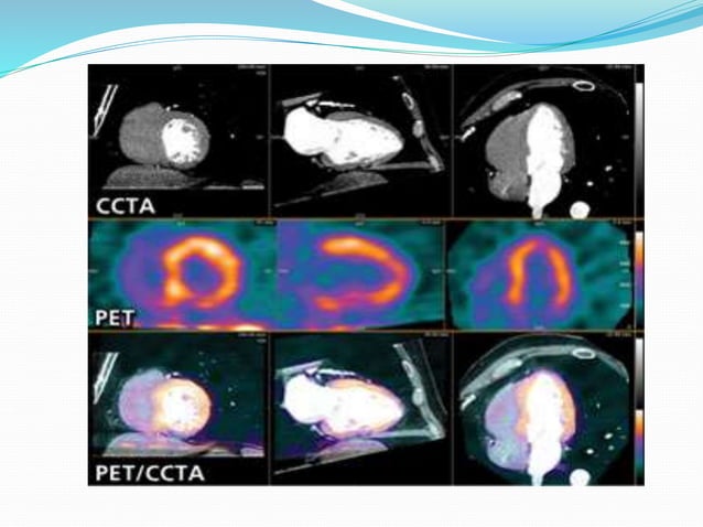 Nuclear Medicine - Cardiac PET/CT | PPTX