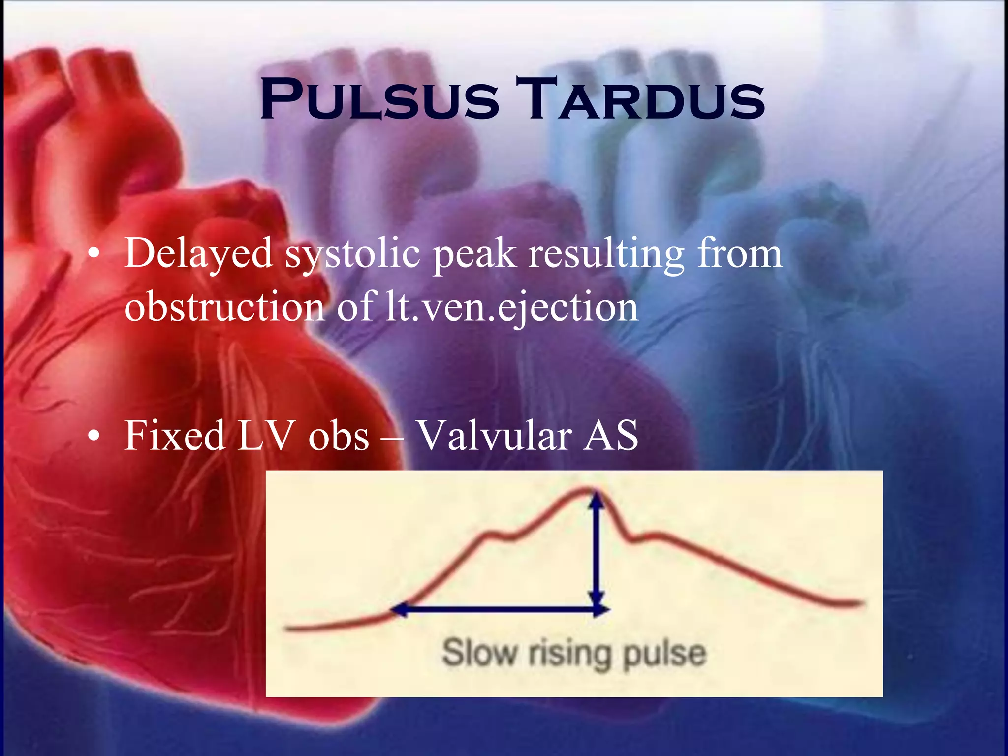 Cardiac physical exam and innocent murmurs presentation | PDF