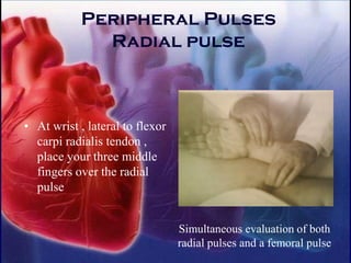 Cardiac physical exam and innocent murmurs presentation | PDF