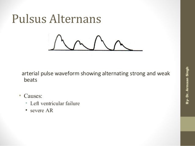 Cardiacphysiology&anaestheticconsiderationscardiacoutput,pulse,bp,car…