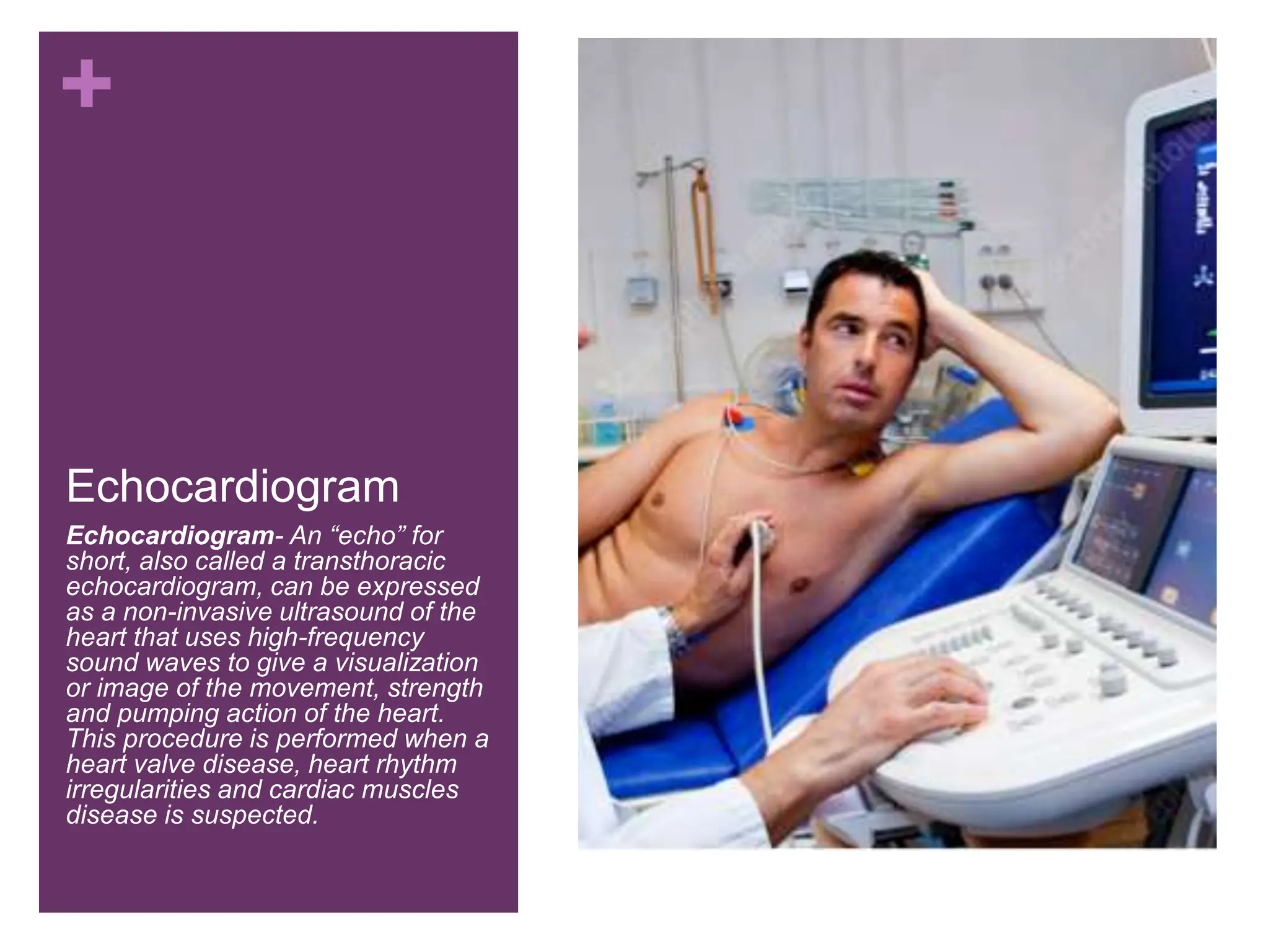 CARDIAC PRESENTATION - NON INVASIVE PROCEDURES | PPTX