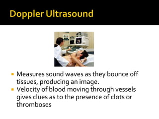 Cardiac procedures presentation bio 120 | PPTX