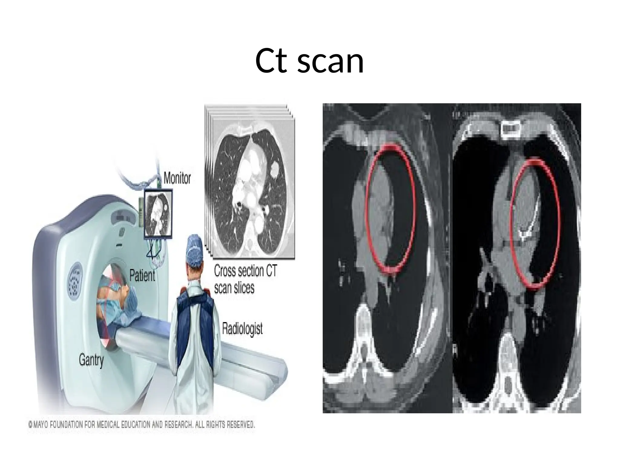 Cardiac profile test ( cardiac function test.pptx