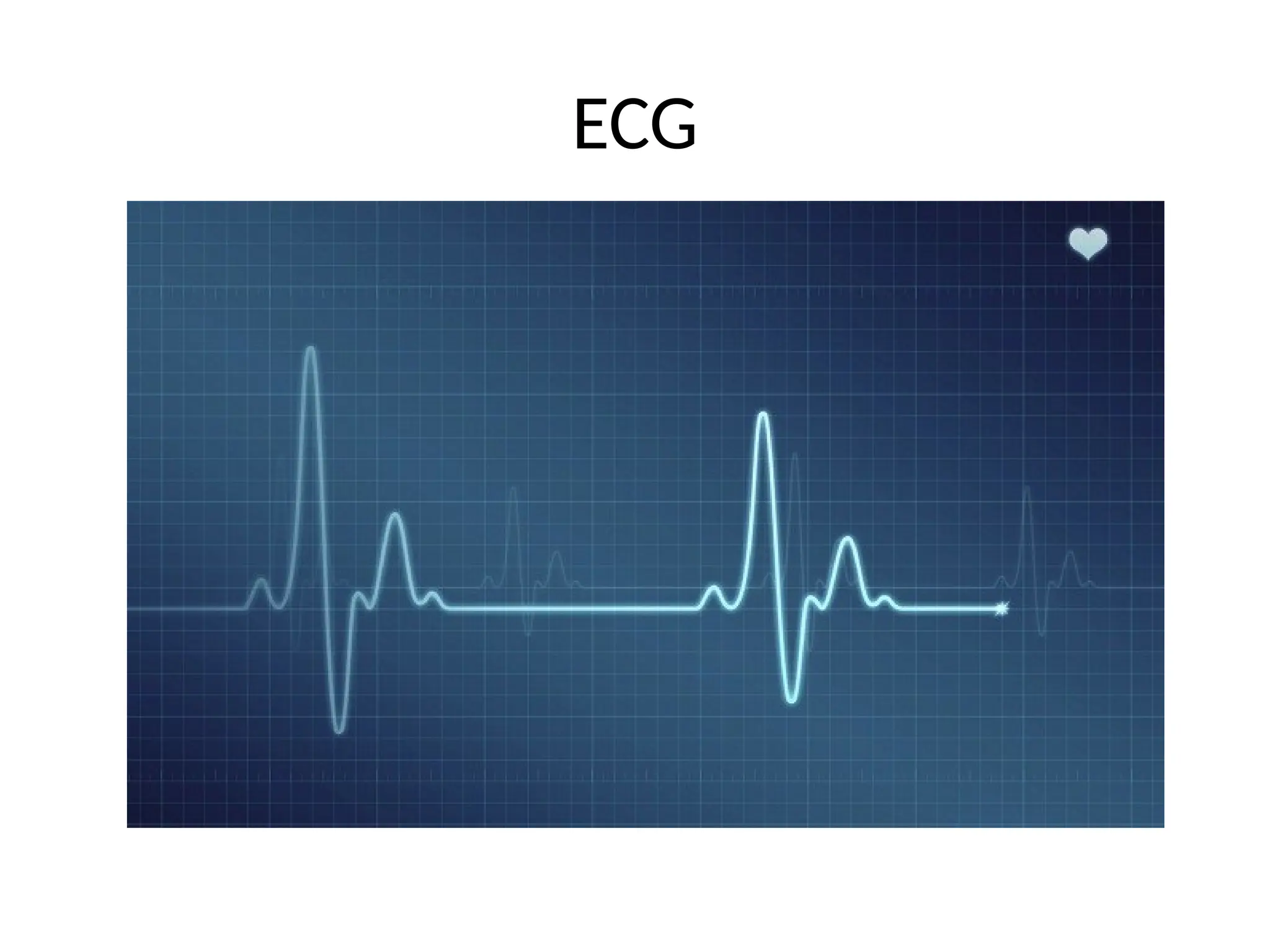Cardiac profile test ( cardiac function test.pptx