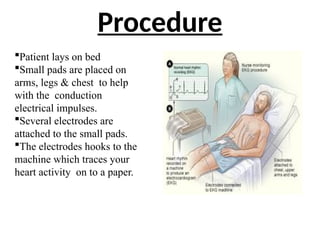 Cardiac profile test ( cardiac function test.pptx