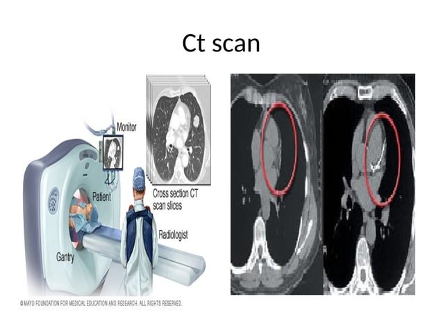 Cardiac profile test ( cardiac function test.pptx