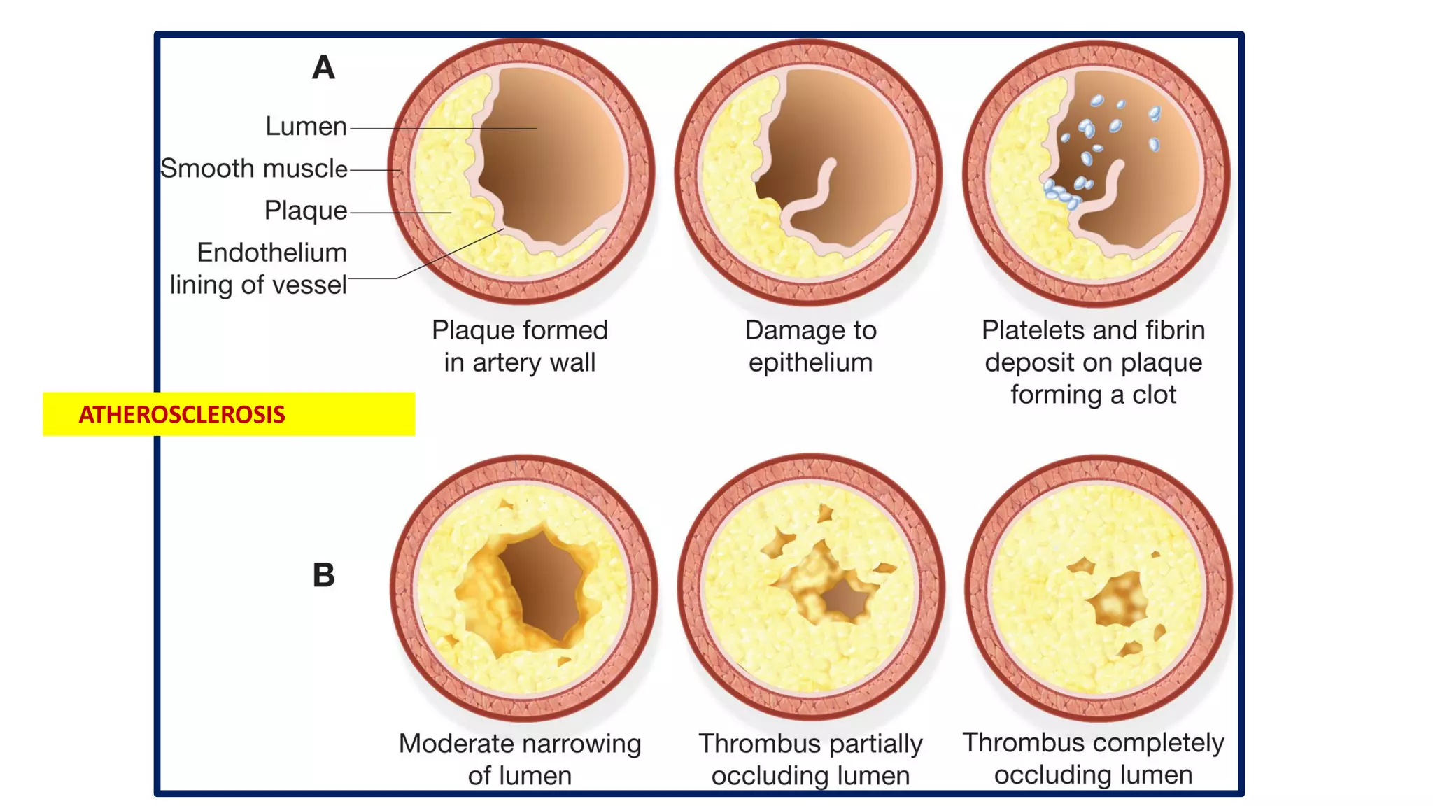 Cardiac profile tests(biochemical ) | PDF