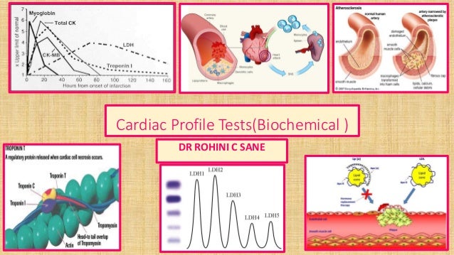 Cardiac profile tests(biochemical )