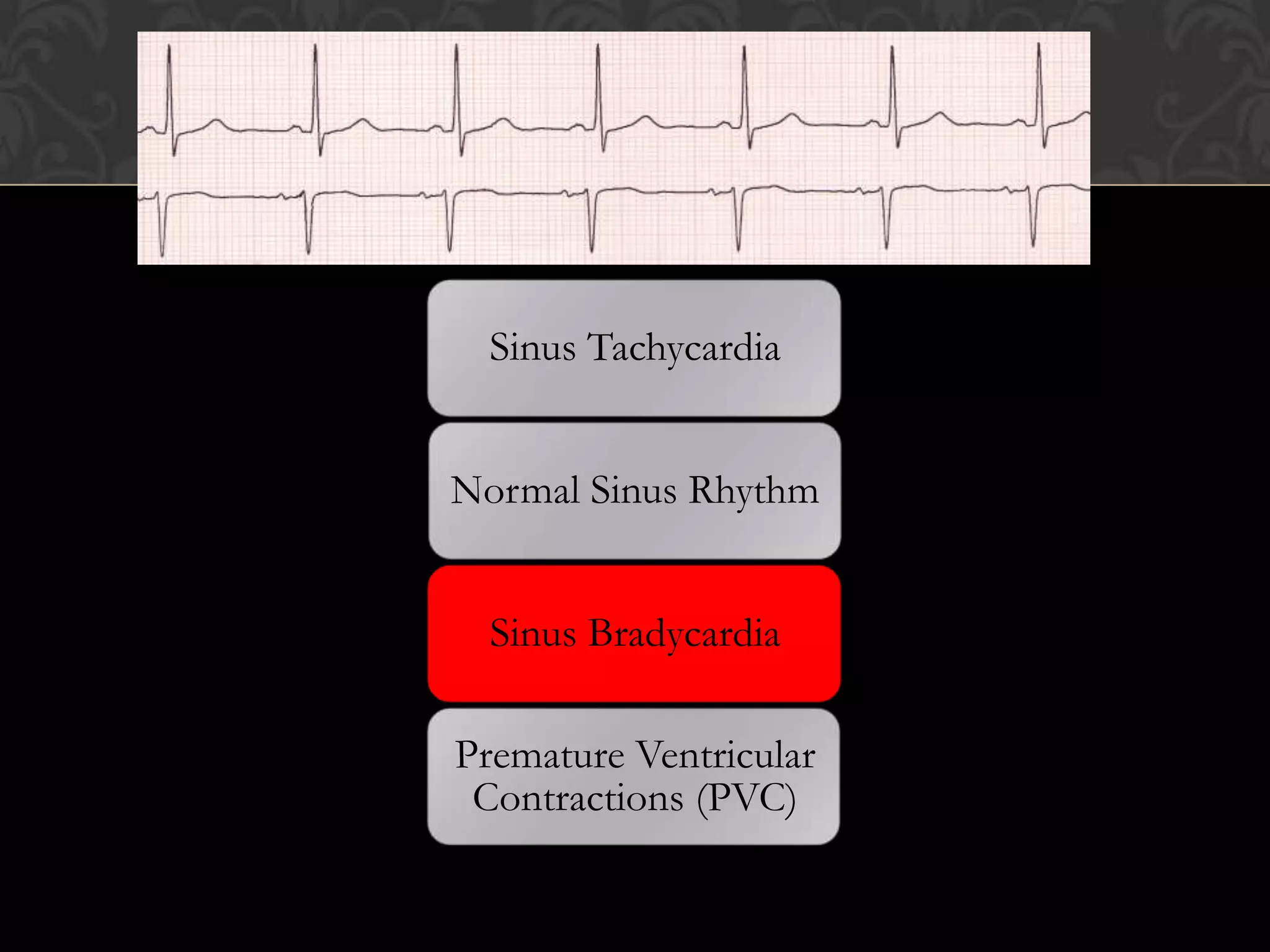 Cardiac quiz me | PPTX