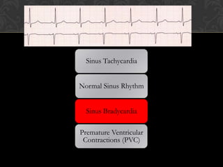 Cardiac quiz me | PPTX