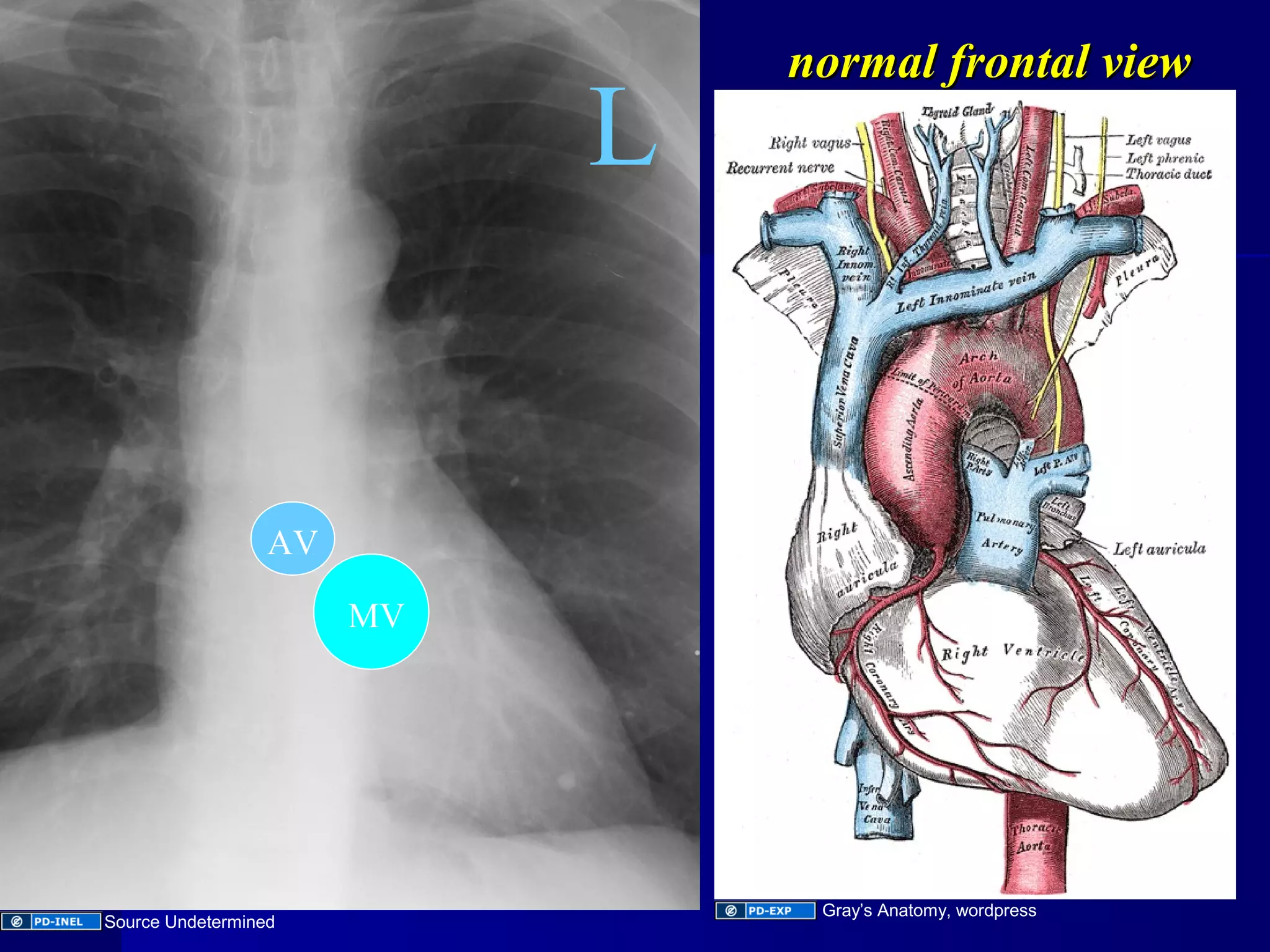 Cardiac radiology | PPT
