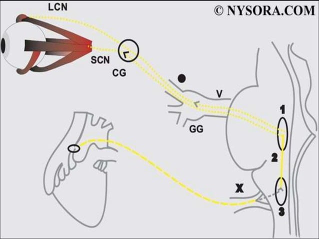 Cardiac reflex | PPTX | Heart and Cardiovascular Diseases | Diseases ...