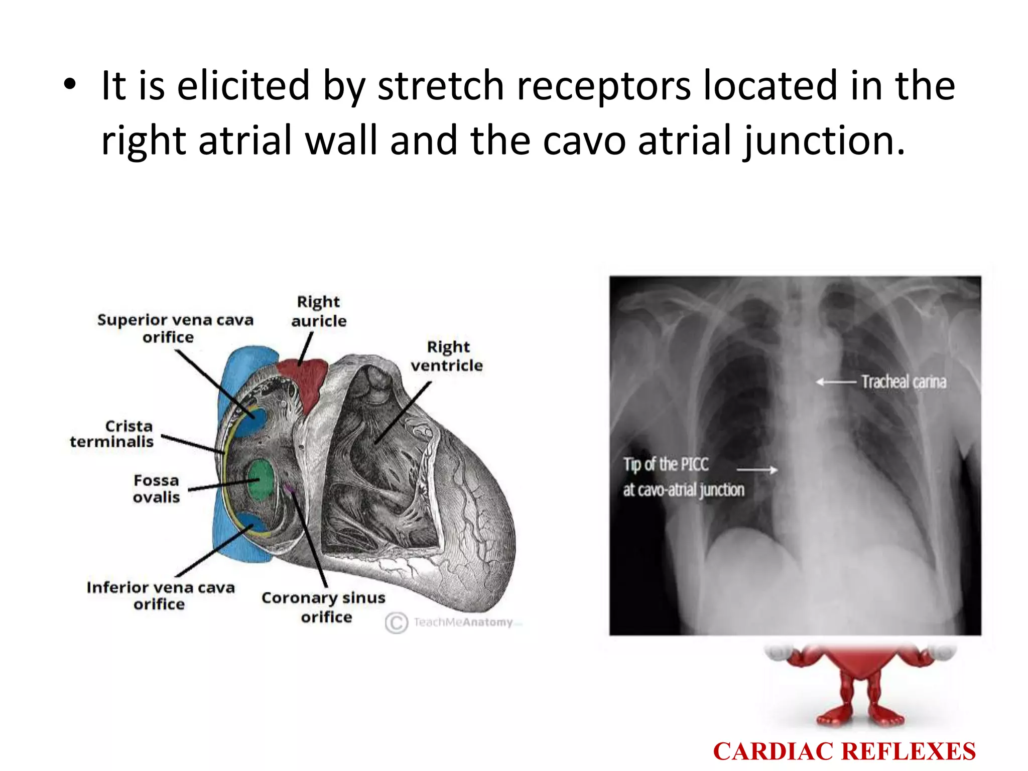 Cardiac reflexes & Anaesthetic Implications | PPTX