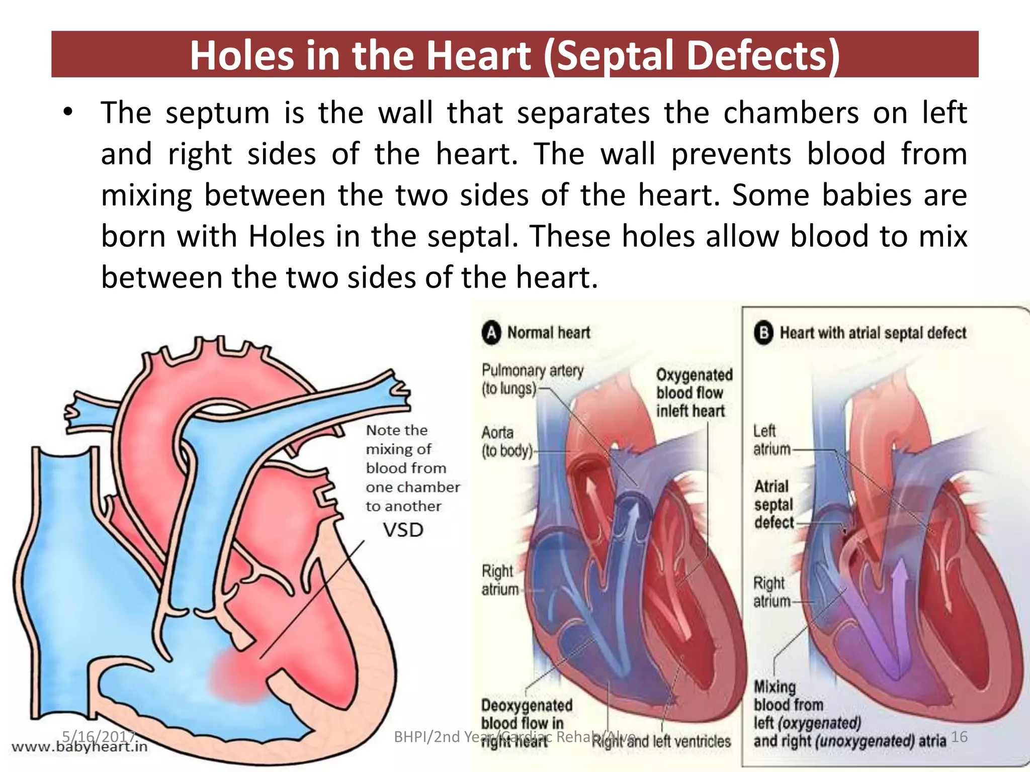 Cardiac Rehabilitation | PPTX