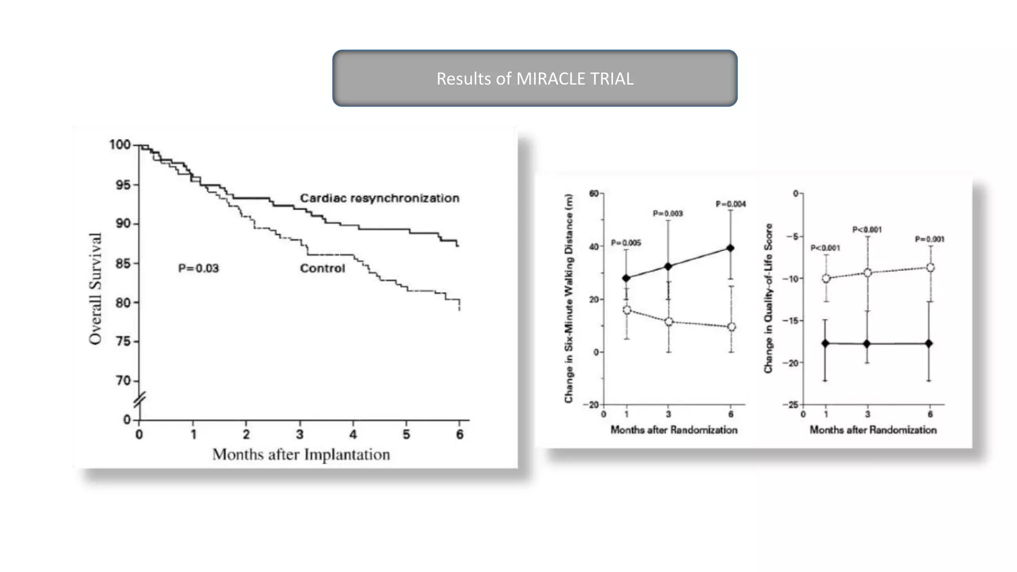 Cardiac Resynchronisation therapy.pptx