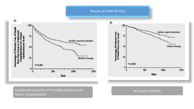 Cardiac Resynchronisation therapy.pptx
