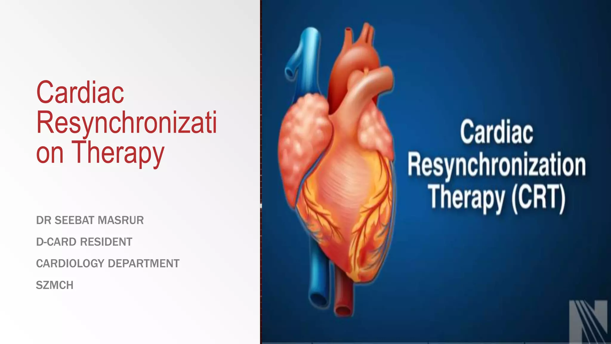 Cardiac Resynchronization therapy.pptx