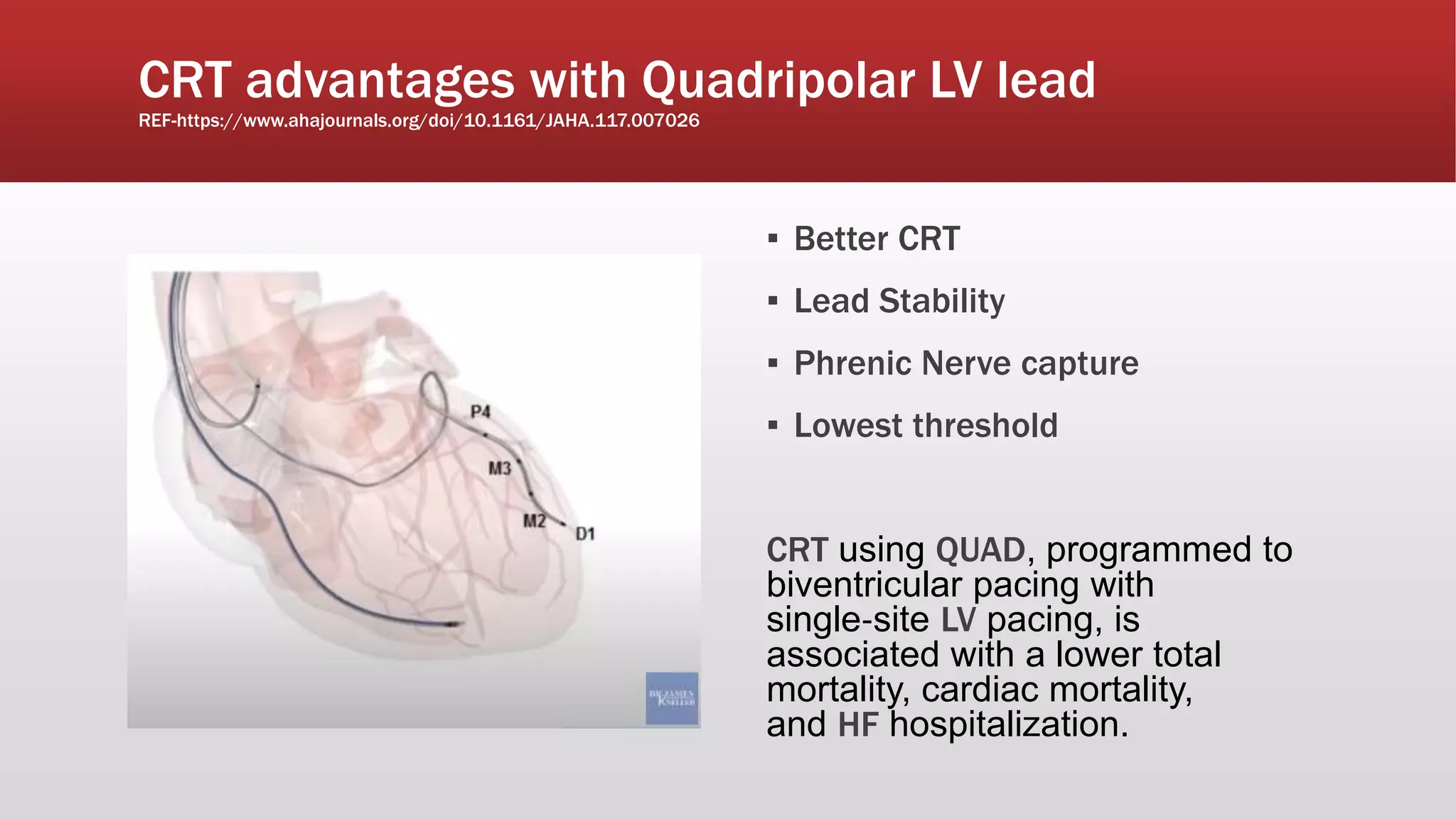 Cardiac Resynchronization therapy.pptx