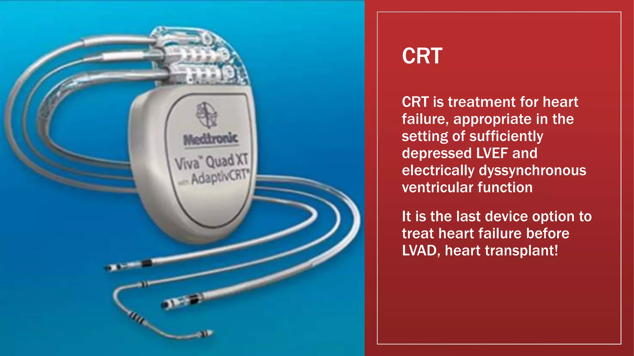 Cardiac Resynchronization therapy.pptx