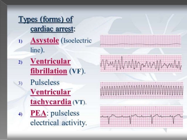 Cardiac rhythm disorders