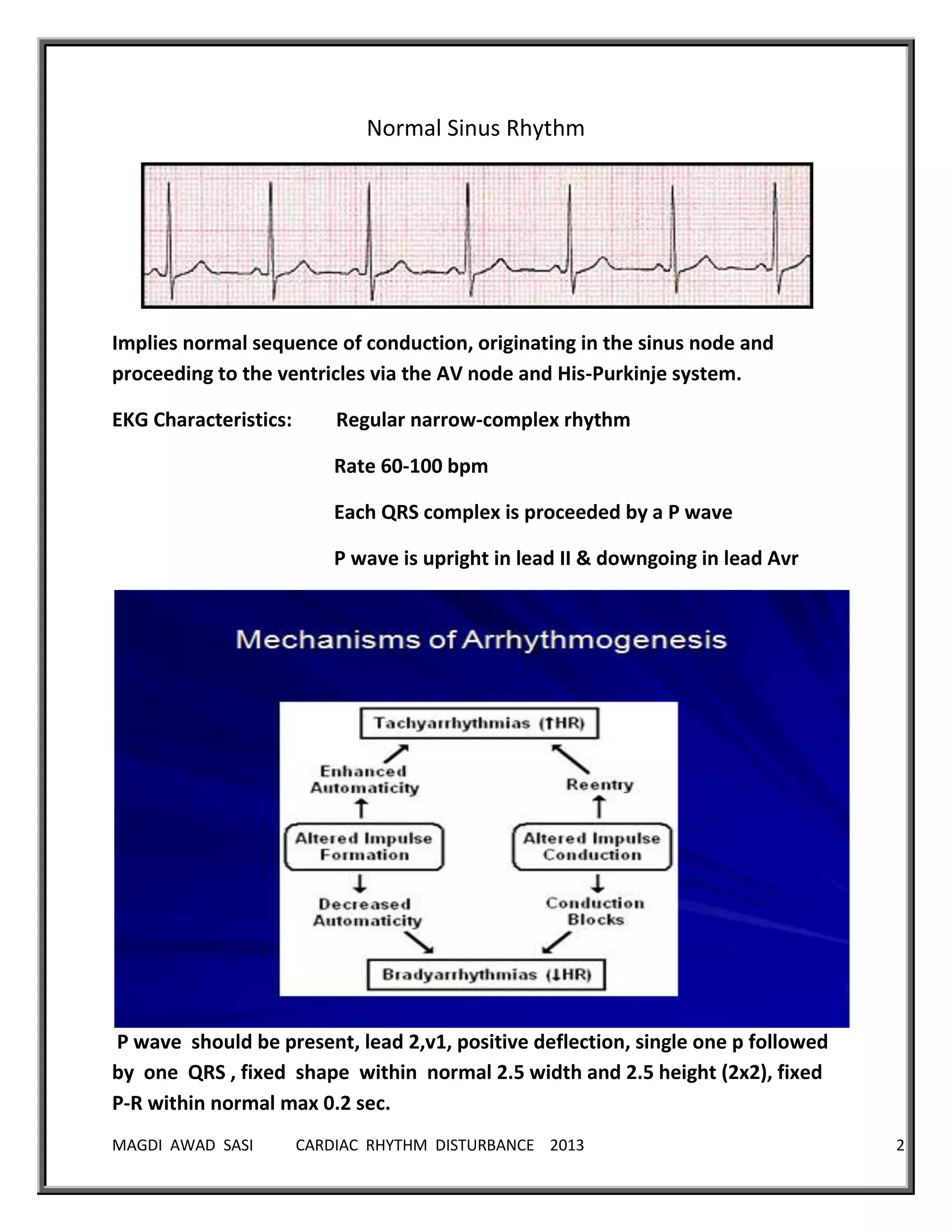 Cardiac rhythm disturbance | DOCX