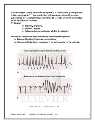 Cardiac rhythm disturbance | PDF