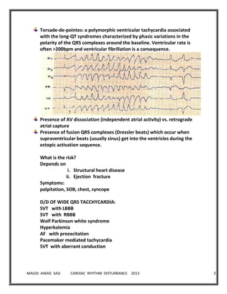 Cardiac rhythm disturbance | PDF