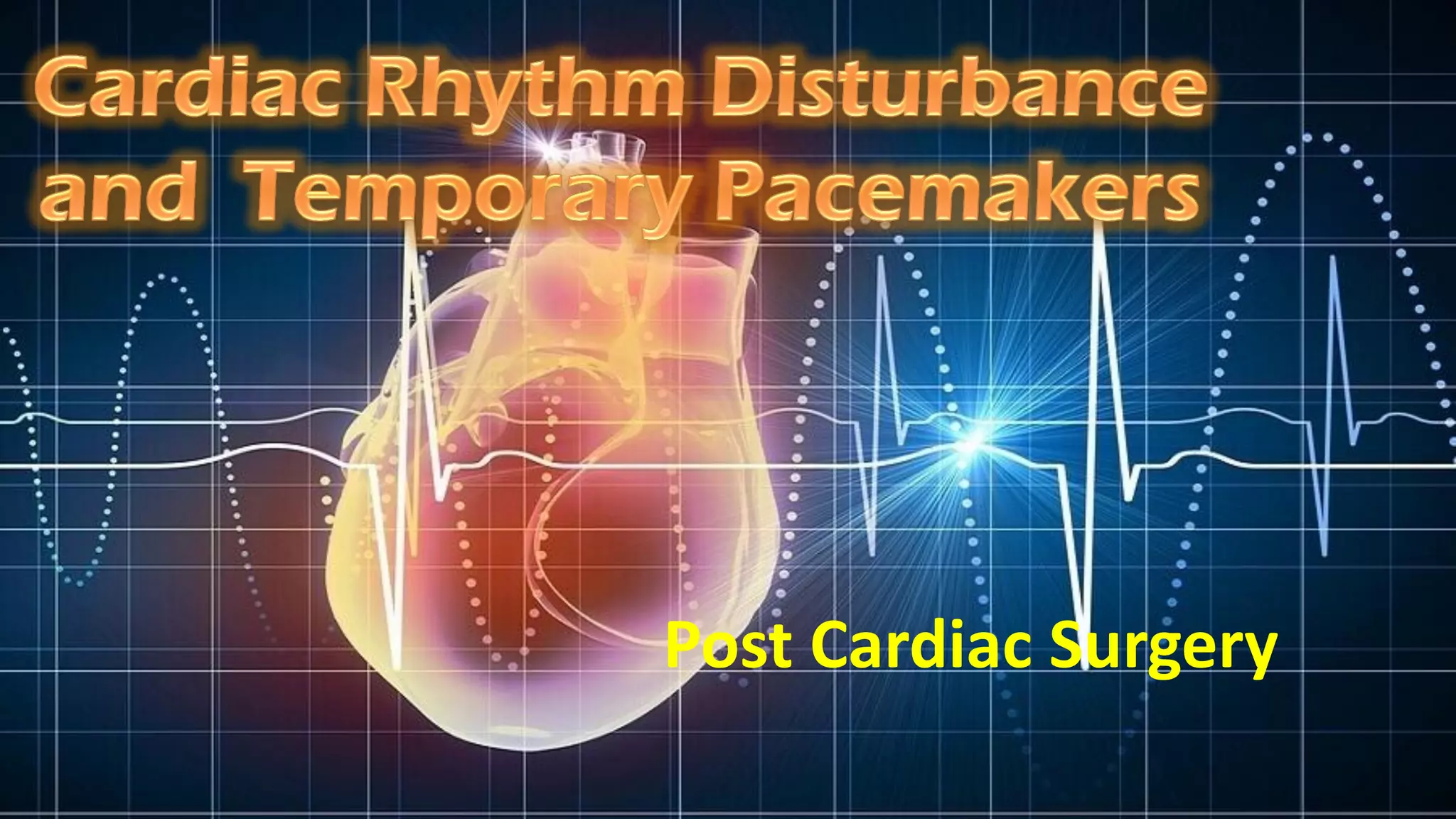 Cardiac Rhythm Disturbance and Temporary Pacemakers.pdf
