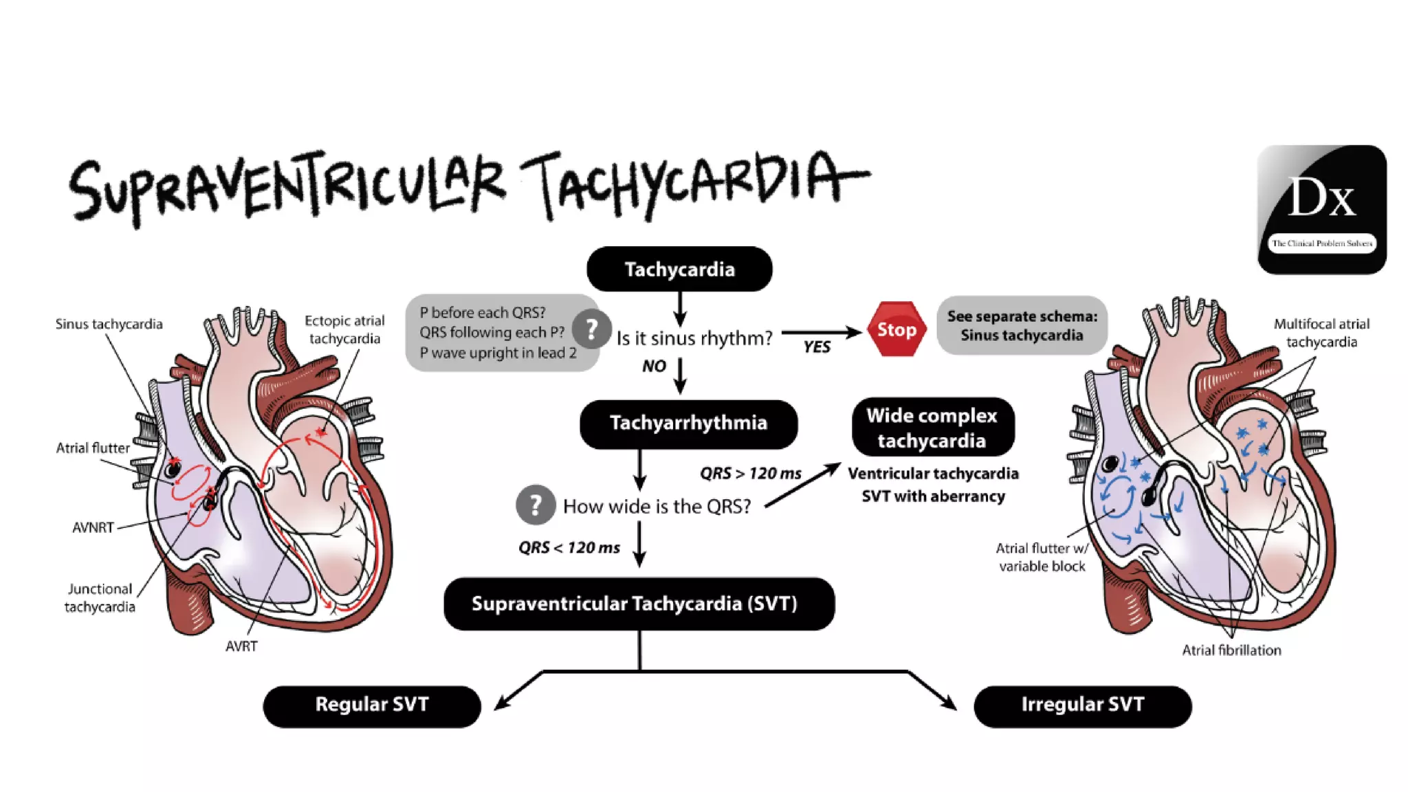 Cardiac Rhythm Disturbance and Temporary Pacemakers.pdf