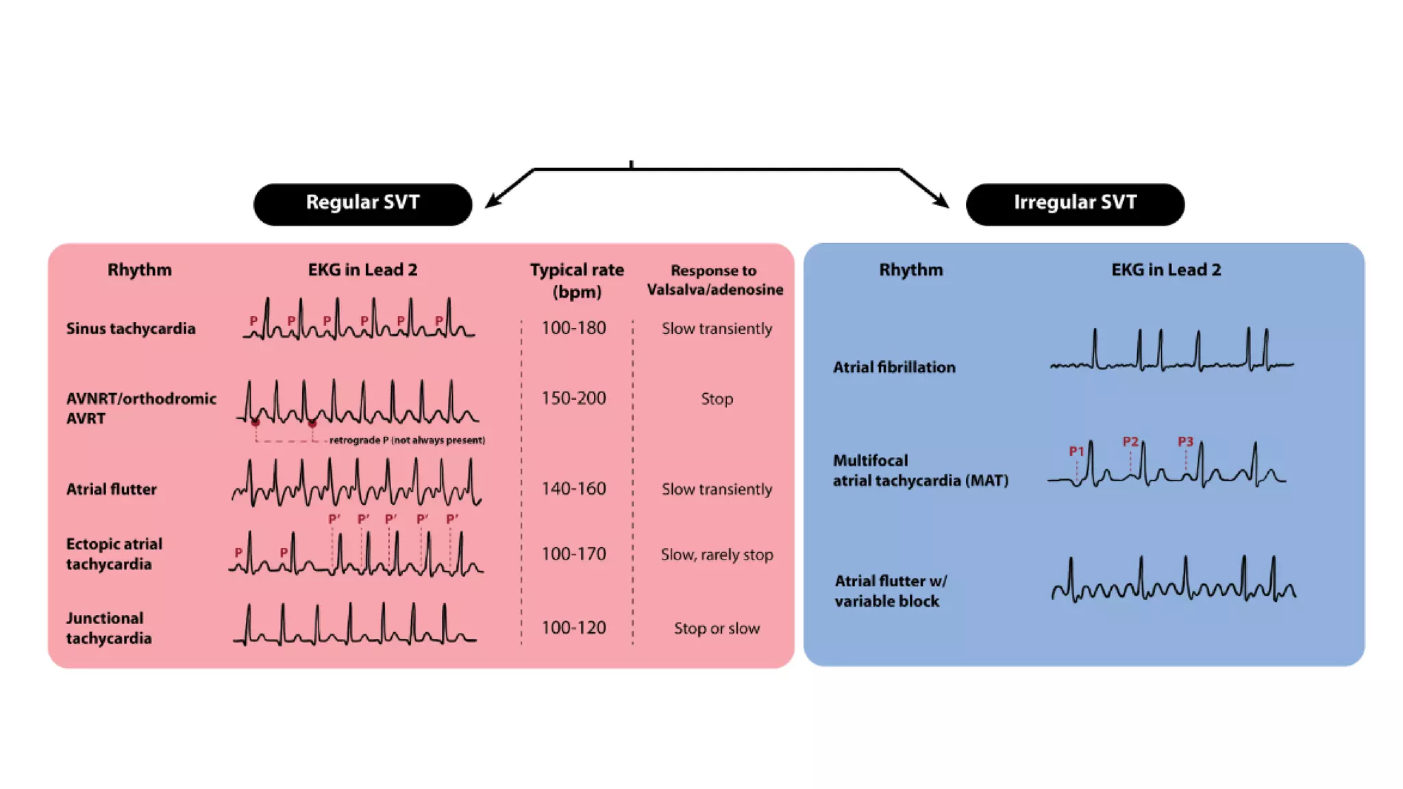 Cardiac Rhythm Disturbance and Temporary Pacemakers.pdf