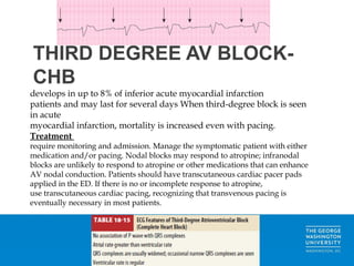 CARDIAC RHYTHM DISTURBANCES- clinicals and management | PPTX