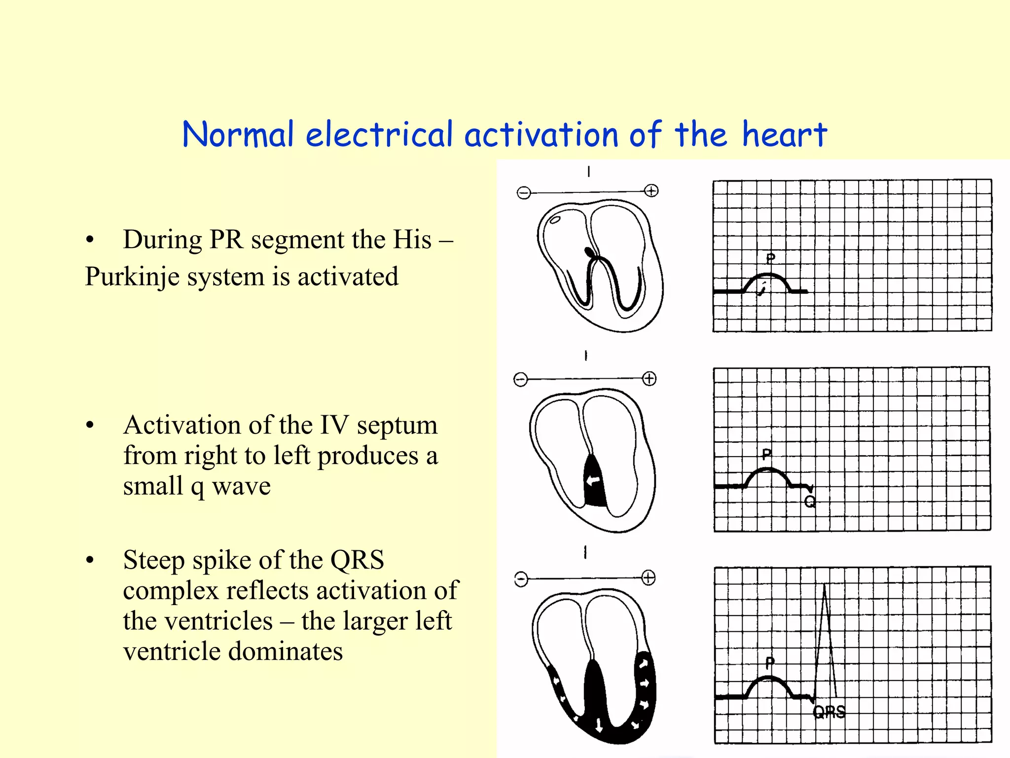 Cardiac Rhythmdysrhythmia | PDF