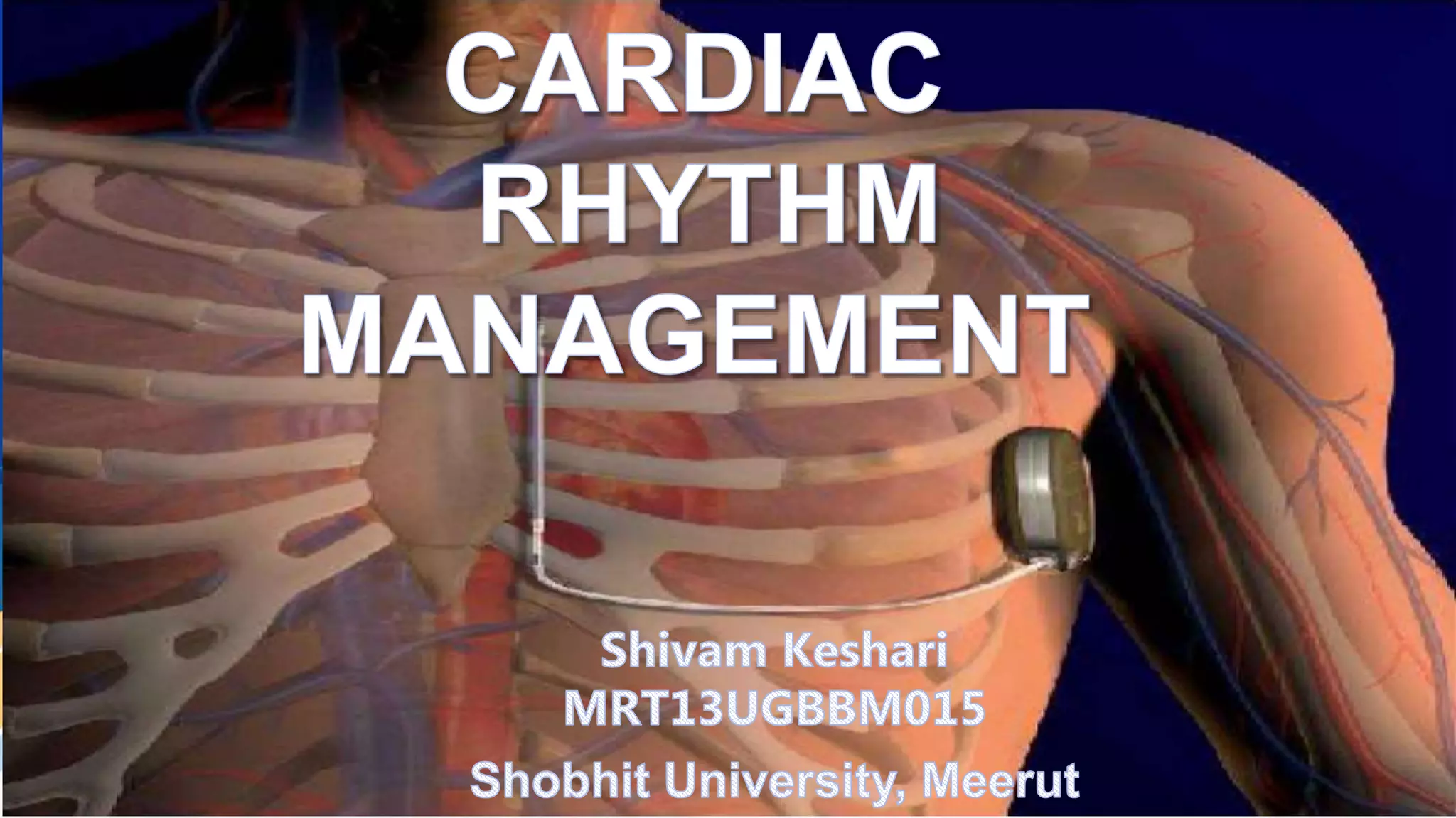 Cardiac rhythm management | PPT