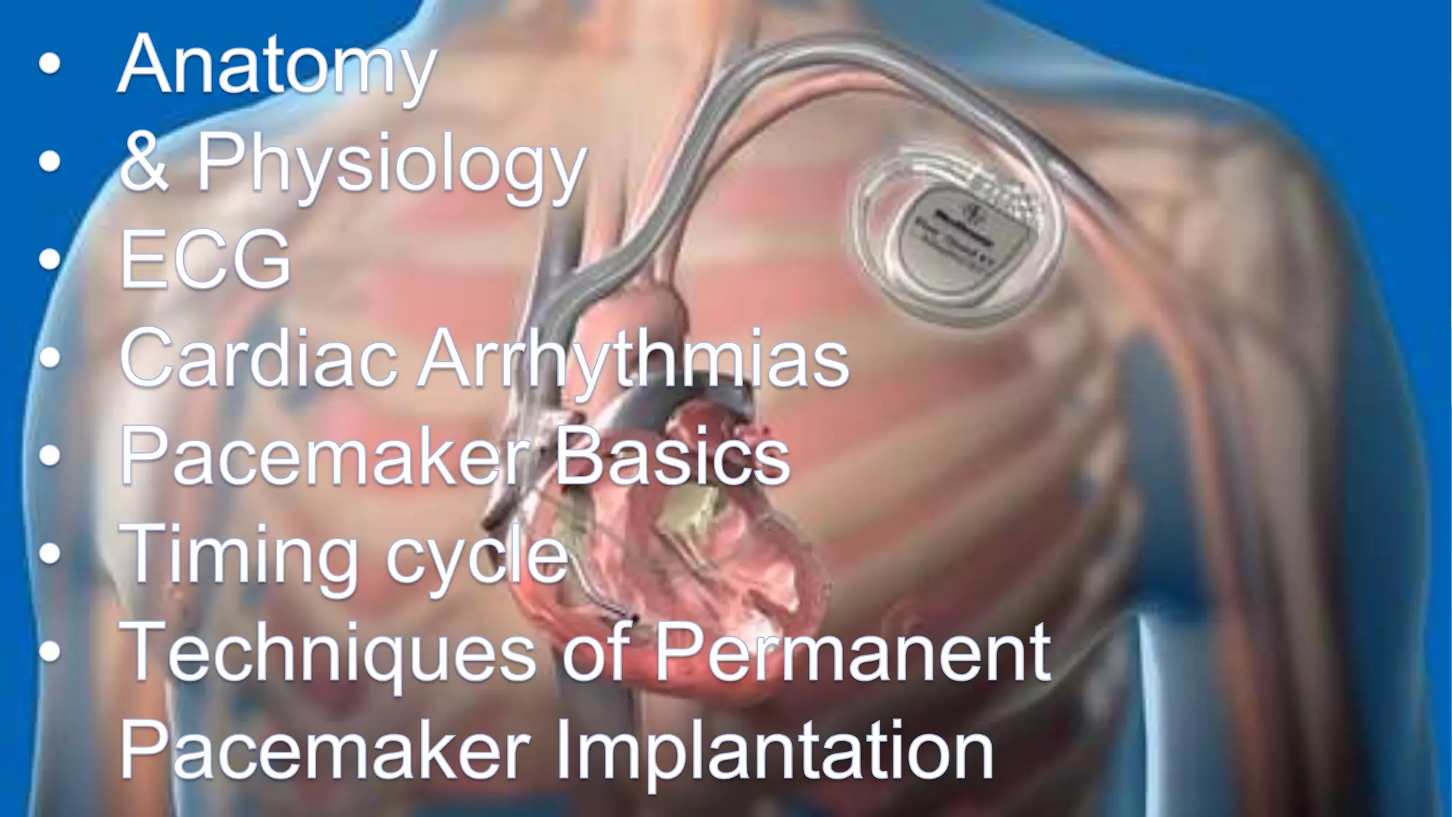 Cardiac rhythm management | PPT