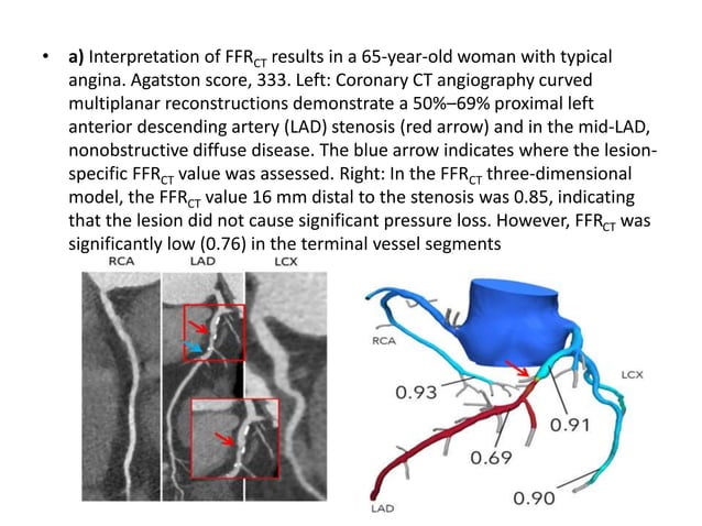Cardiac risk stratification.pptx