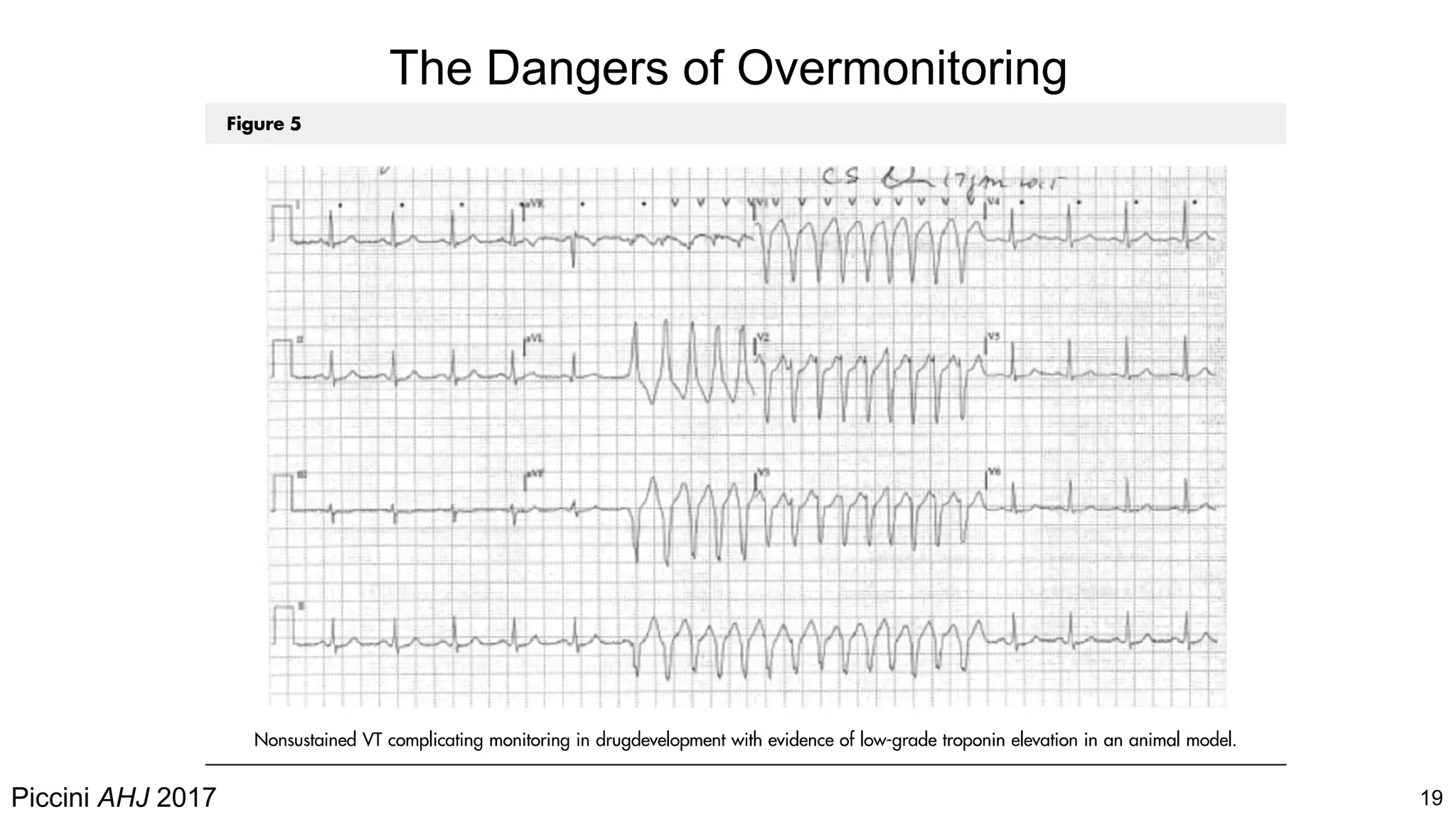 Cardiac Safety in Drug Development | PPT