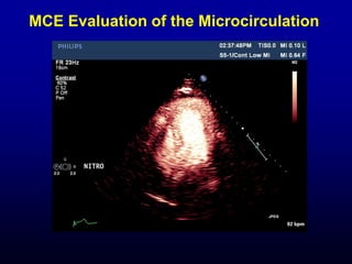 Cardiovascular Manifestations, Systemic Sclerosis by Dr. Jonathan R ...
