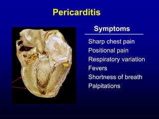 Cardiovascular Manifestations, Systemic Sclerosis by Dr. Jonathan R ...