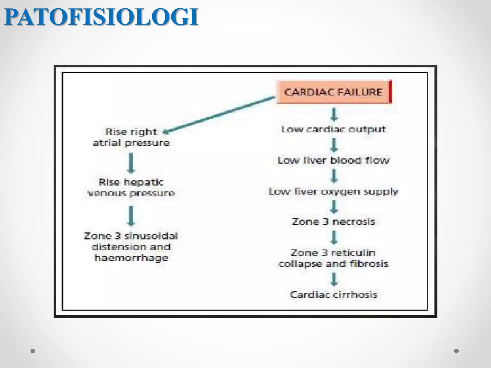 Cardiac sirosis | PPTX